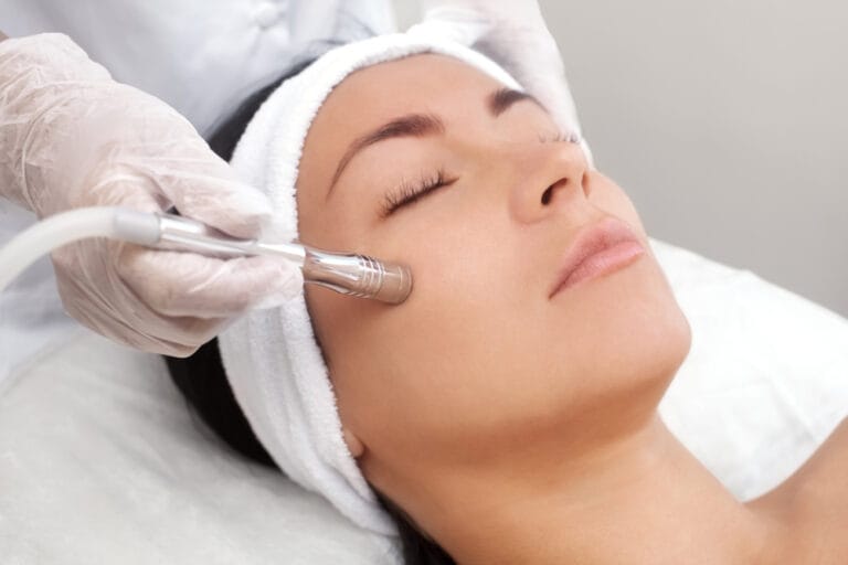 What is Diamond Peel?